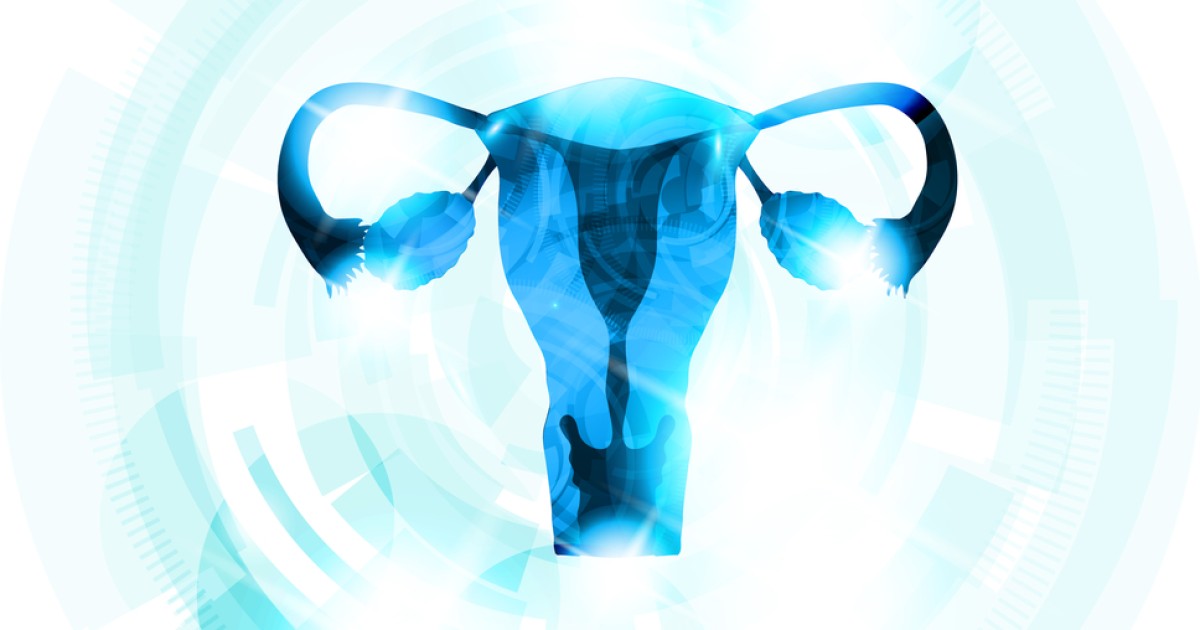 Sentinel Node Biopsy In Uterine Cancer Endo3 Trial Professor Andreas Obermair